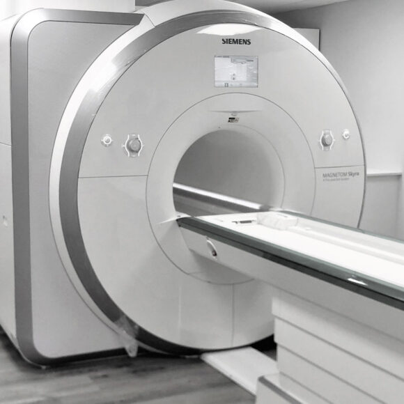 3 Tesla MRI Scan in Dubai – Advanced Imaging with Accuracy