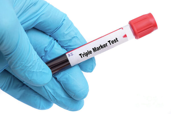 Triple Marker Test in Pregnancy: Timing, Procedure & Cost Guide